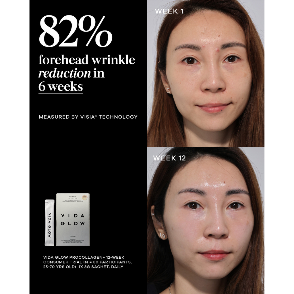 Vida Glow Pro Collagen + NZ | Adore Beauty