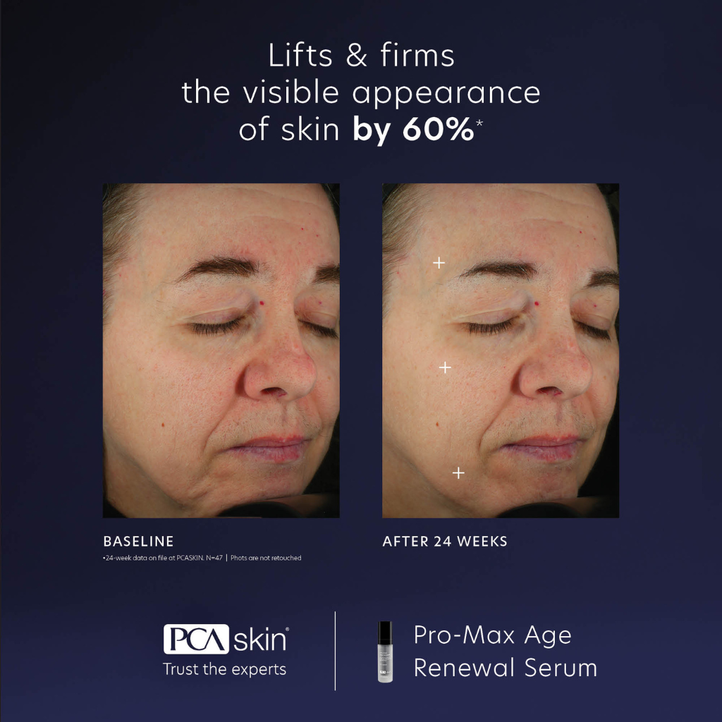 PCA Skin Pro-Max Age Renewal NZ | Adore Beauty